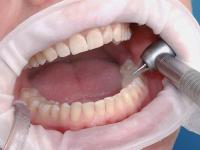 Optragate retractor | CrocoDental.eu